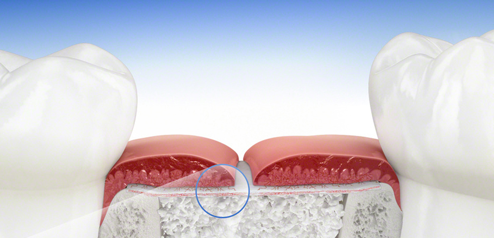 Zahnfleischbehandlungen • Zahnmedizin Rostock